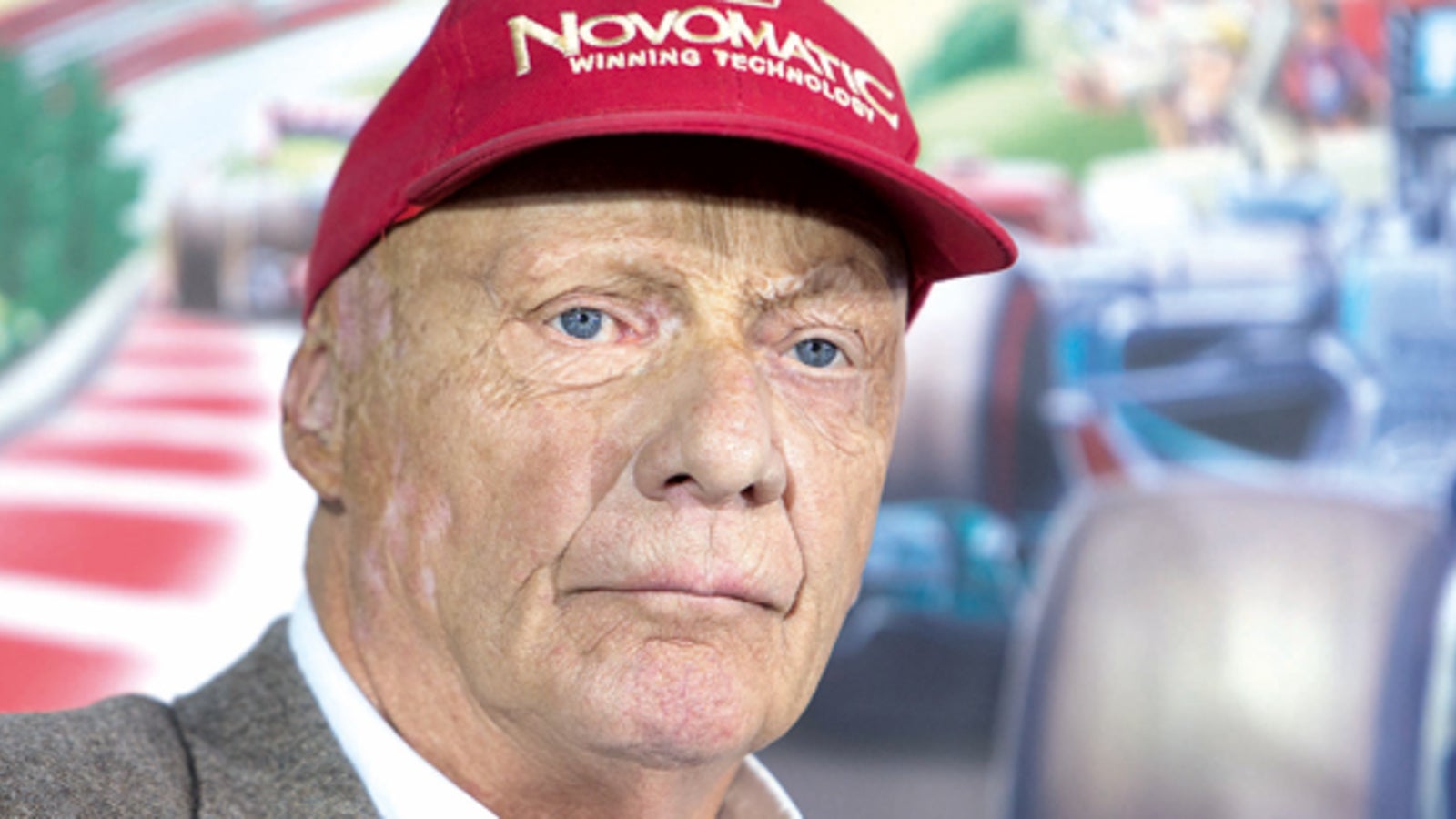 Lauda kämpft um sein Leben - oe24.at