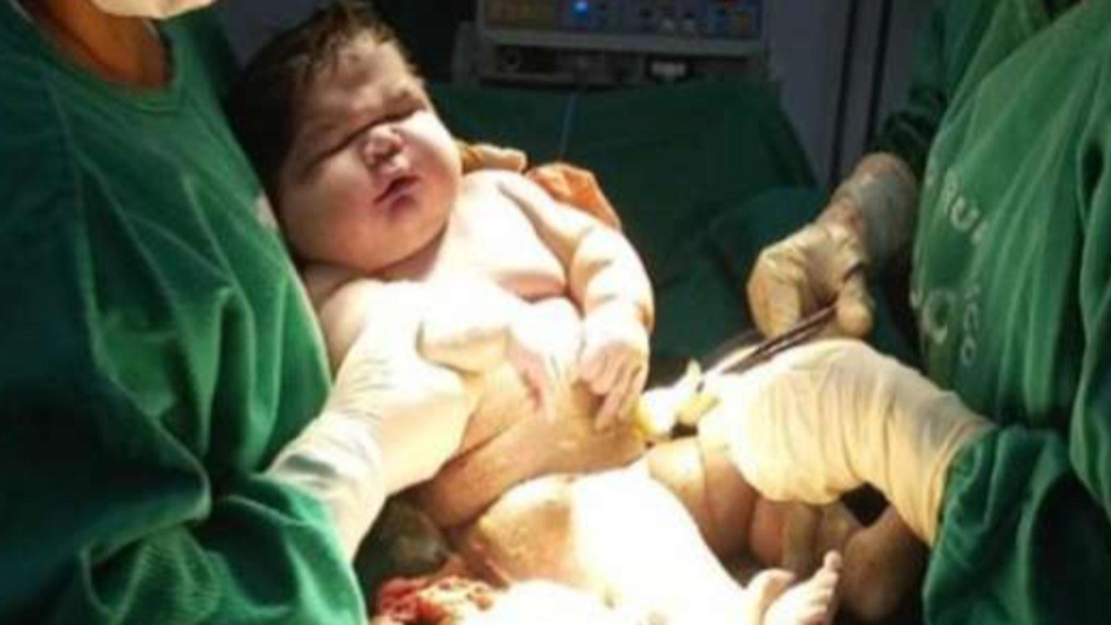 Verrückt: Frau bringt sieben Kilo Baby auf die Welt - oe24.at