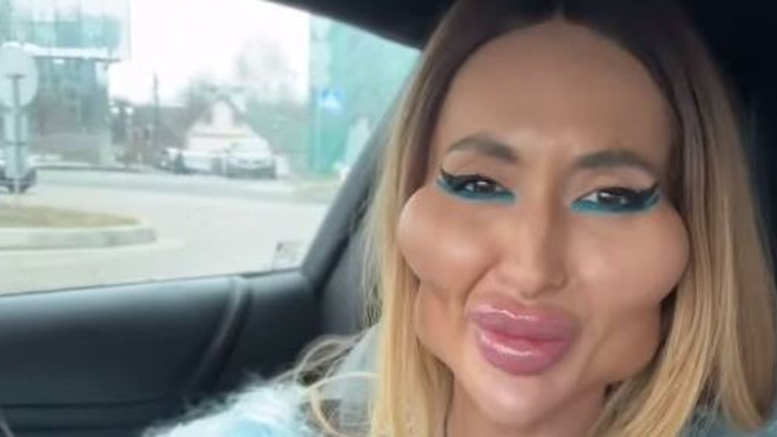 Ukrainische Influencerin hat die "dicksten Backen" der Welt - oe24.at