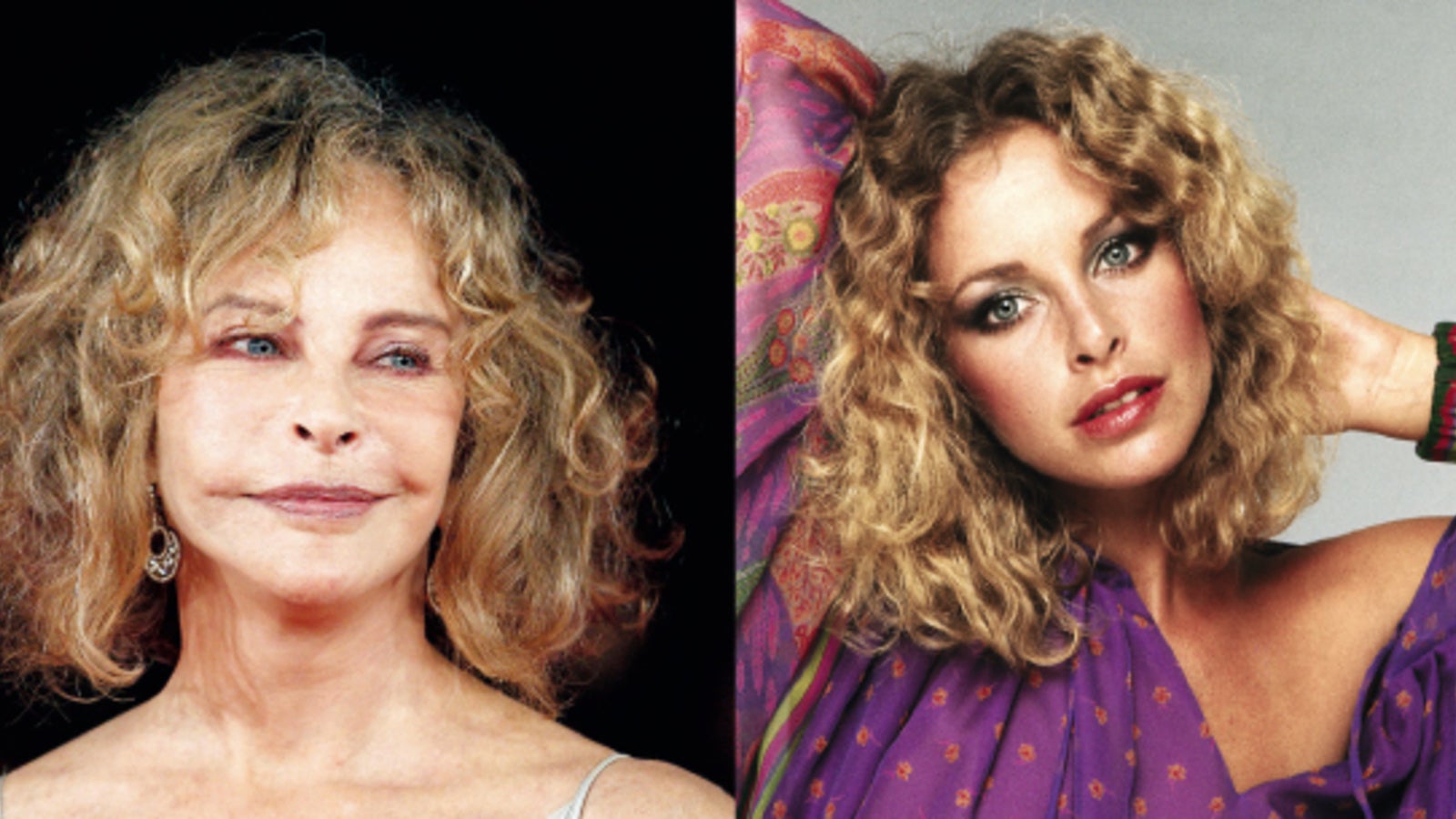 Sydne Rome: Monster der Chirurgie - madonna24.at