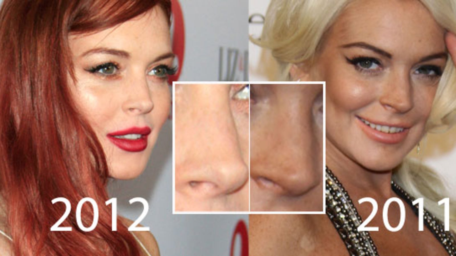 Lohan: Ist das etwa eine neue Nase? - stars24