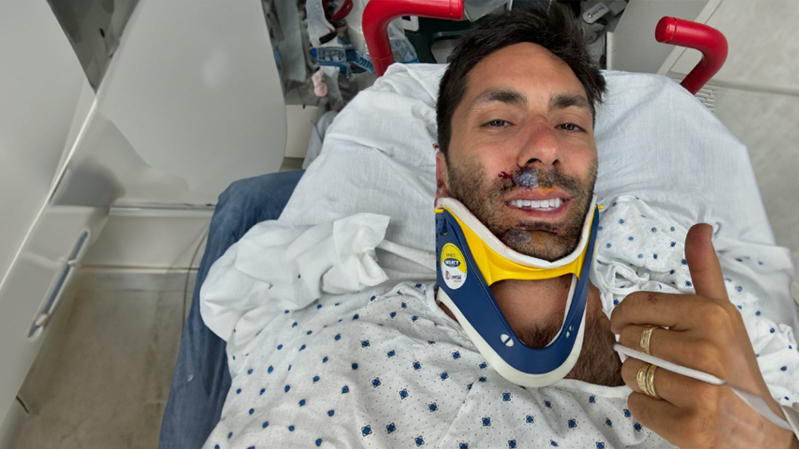 MTV-Star bricht sich bei Fahrrad-Unfall das Genick - stars24