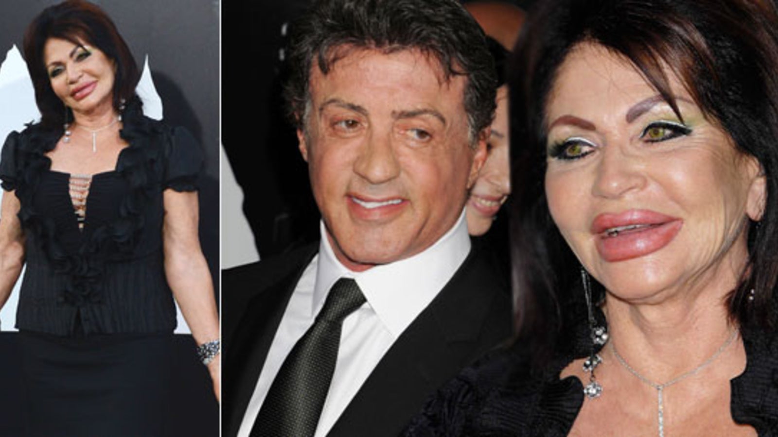 Stallones Mama mutiert zum Botox-Monster - stars24