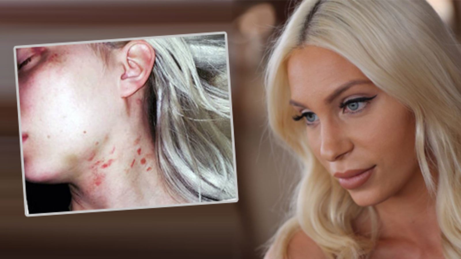 ATV-Star Tara: Wer hat sie misshandelt? - stars24